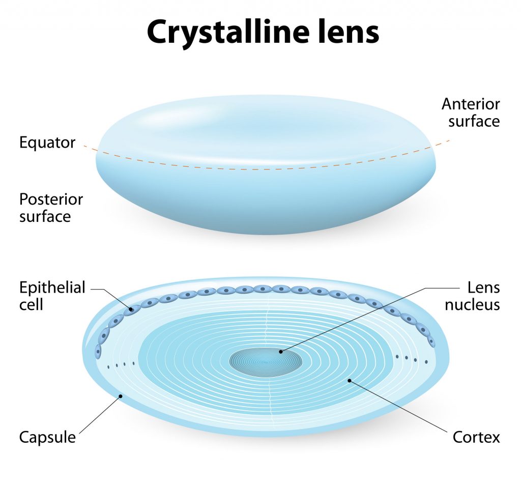 Cataract Surgery and Crystalens® - CataractEye.com